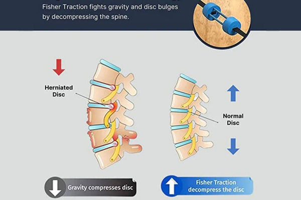 Fisher Traction® Spine Traction Device - Instant Relief for Pinched ...