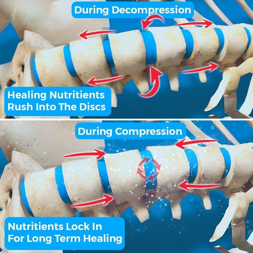 Fisher Traction® Spine Traction Device - Instant Relief for Pinched ...